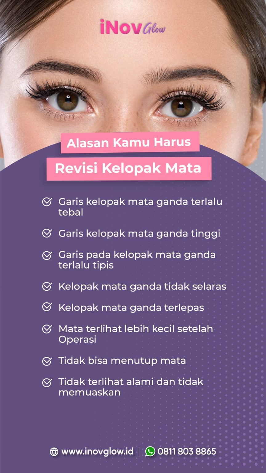 Revisi Lipatan Mata Archives - SPESIALIS BEDAH PLASTIK